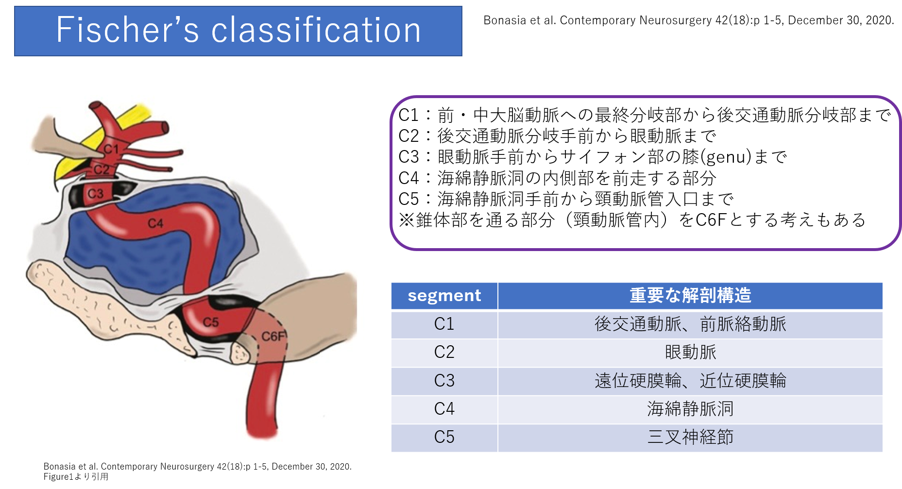 内頚動脈(ICA)の解剖とセグメント | ラジブロ—一流の放射線技師を目指すためのブログ—